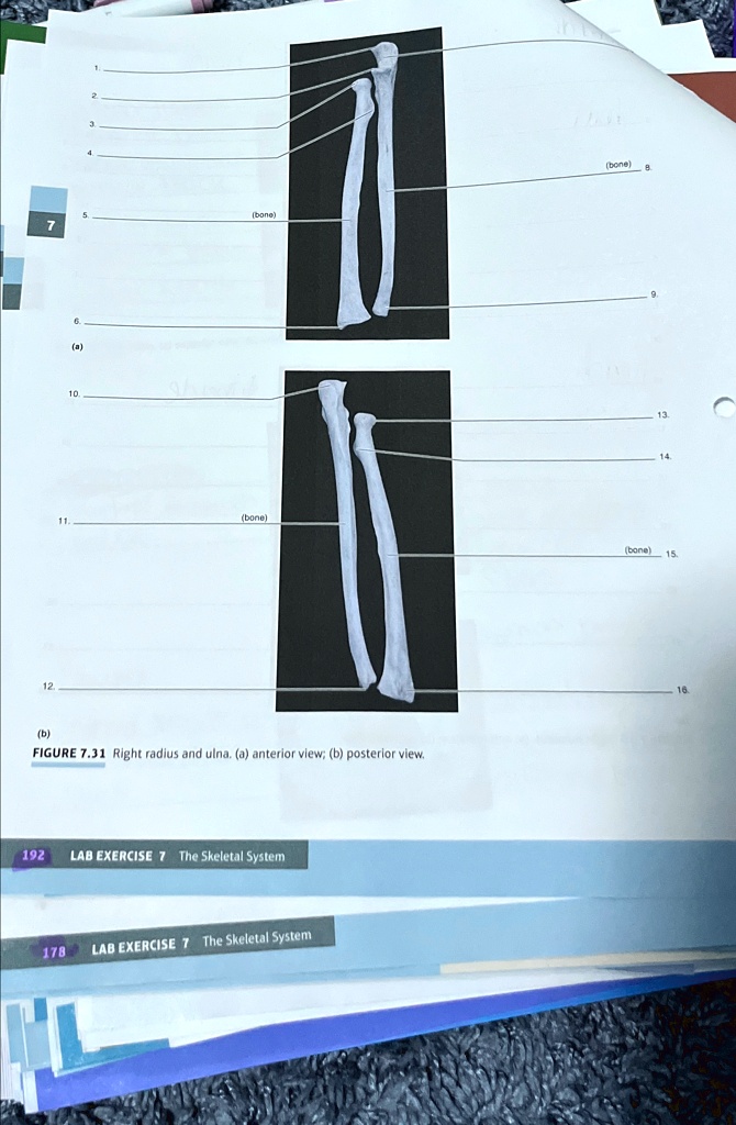 7 12 (a) 10 (bone) (bone) (b) FIGURE 7.31 Right radius and ulna. (a ...