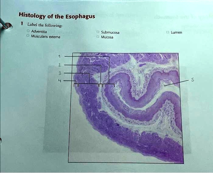 Histology of the Esophagus Label the following: Adventitia Submucosa ...