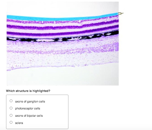 SOLVED: Which structure is highlighted? axons of ganglion cells ...