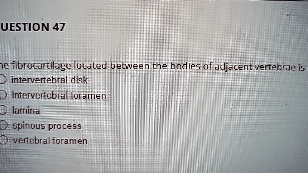 UESTION 47 ne fibrocartilage located between the bodies of adjacent ...