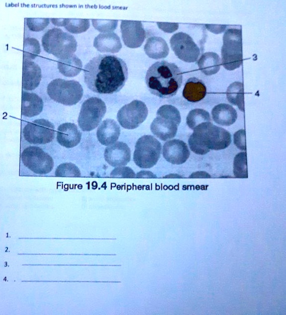 SOLVED: Label the structures shown in theb lood smear Figure 19.4 ...