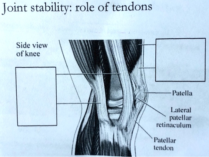 SOLVED: Joint stability: role of tendons Side view of knee Patella ...