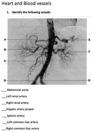 i need help please heart and blood vessels 1identify the following vessels a b c abdominal aorta ...