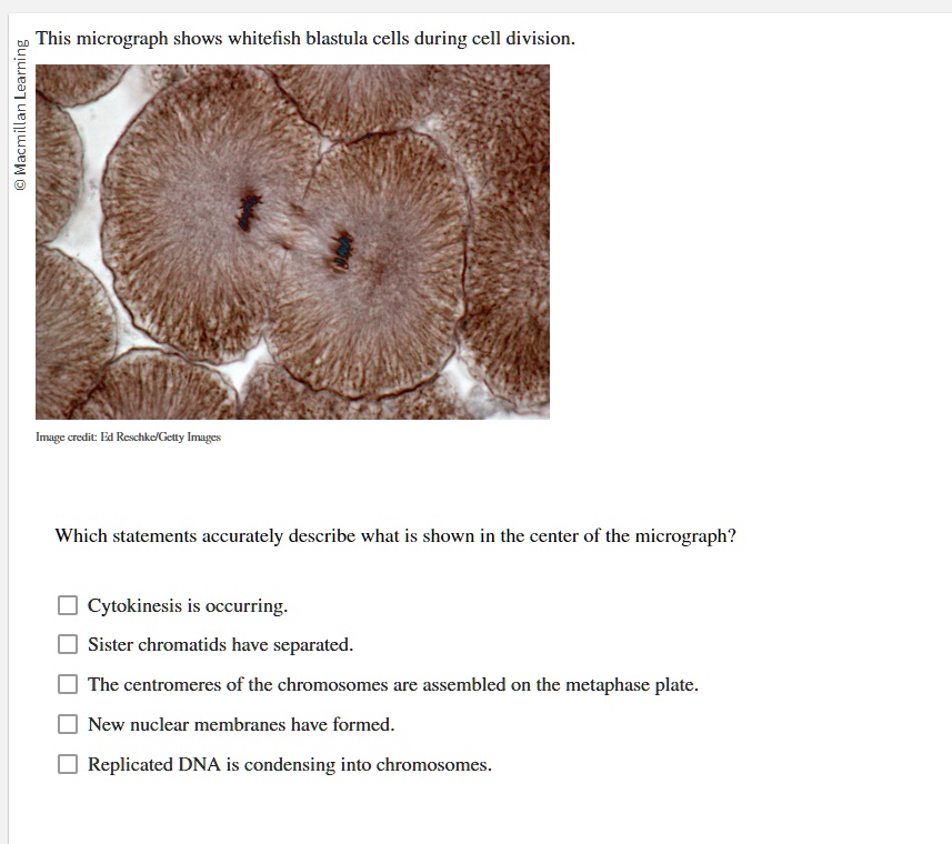 This micrograph shows whitefish blastula cells during cell division ...