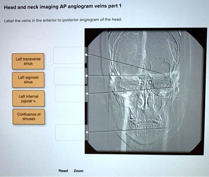 SOLVED: Head and Neck Imaging: AP Angiogram Veins - Part 1 Label the ...
