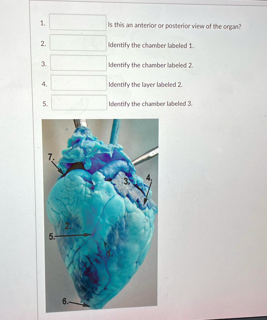 SOLVED: Is this an anterior or posterior view of the organ? Identify ... SOLVED: Is this an anterior or posterior view of the organ? Identify ...
