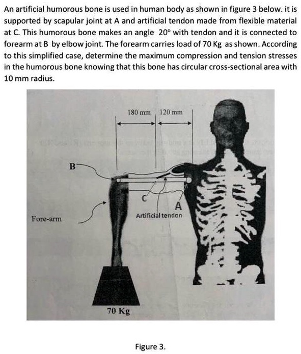 [GET ANSWER] An artificial humorous bone is used in human body as shown ...