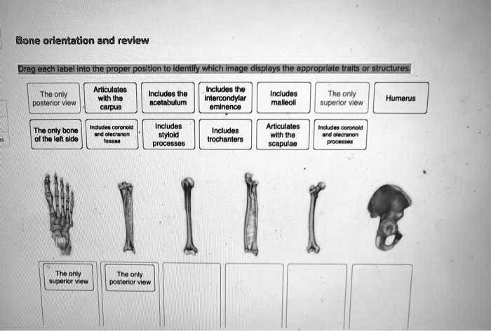 Bone orientation and review Drag each label into the proper position to identify which image ...