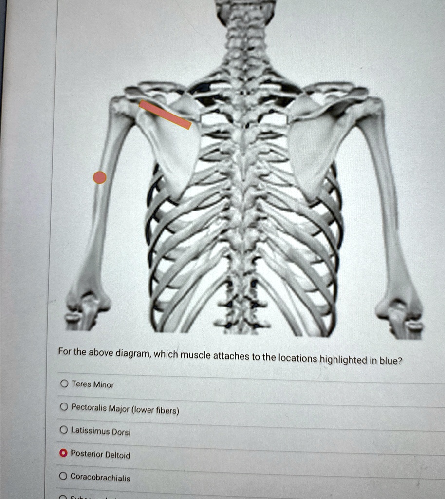 For the above diagram, which muscle attaches to the locations ...