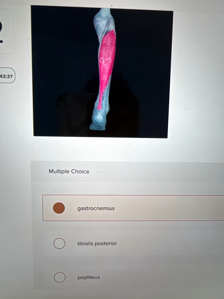 Multiple Choice gastrocnemius tibialis posterior popliteus Multiple ...