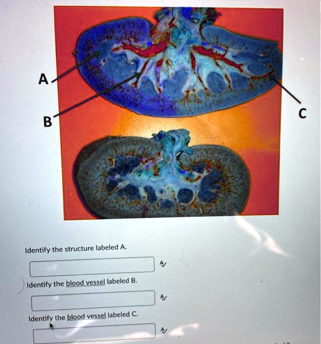 SOLVED: A s B Identify the structure labeled Identify the bloodvessel labeled B. Identify the ...