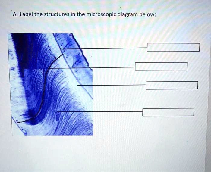 SOLVED: A. Label the structures in the microscopic diagram below: SOLVED: A. Label the structures in the microscopic diagram below: