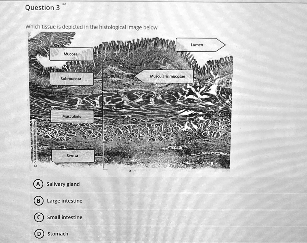 SOLVED: Question 3 Which tissue is depicted in the histological image ...