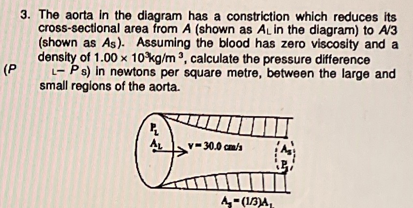 The aorta in the diagram has a constriction which reduces its cross ...