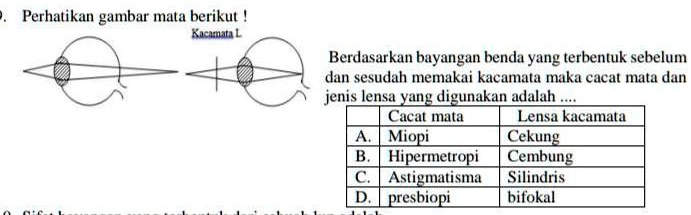 SOLVED: Berdasarkan bayangan benda yang terbentuk sebelum dan sesudah ...