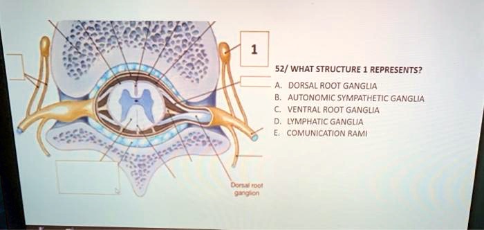 1 Dorsal root ganglion 52/ WHAT STRUCTURE 1 REPRESENTS? A. DORSAL ROOT ...