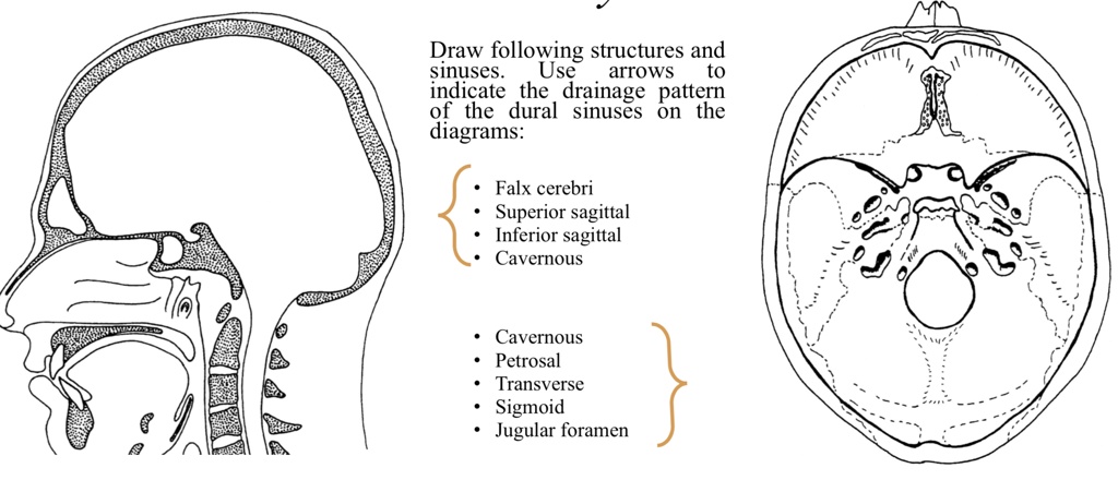 SOLVED: Draw and label the following diagram. Draw the following ...