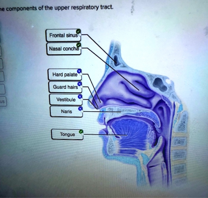 me components of the upper respiratory tract. Frontal sinus Nasal ...
