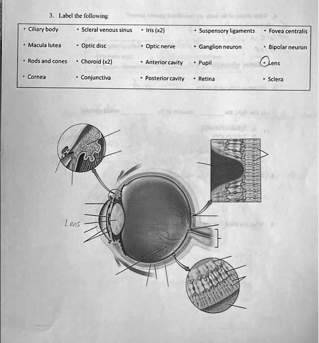 SOLVED: Ciliary body Scleral venous sinus Iris (*21) Suspensory ...