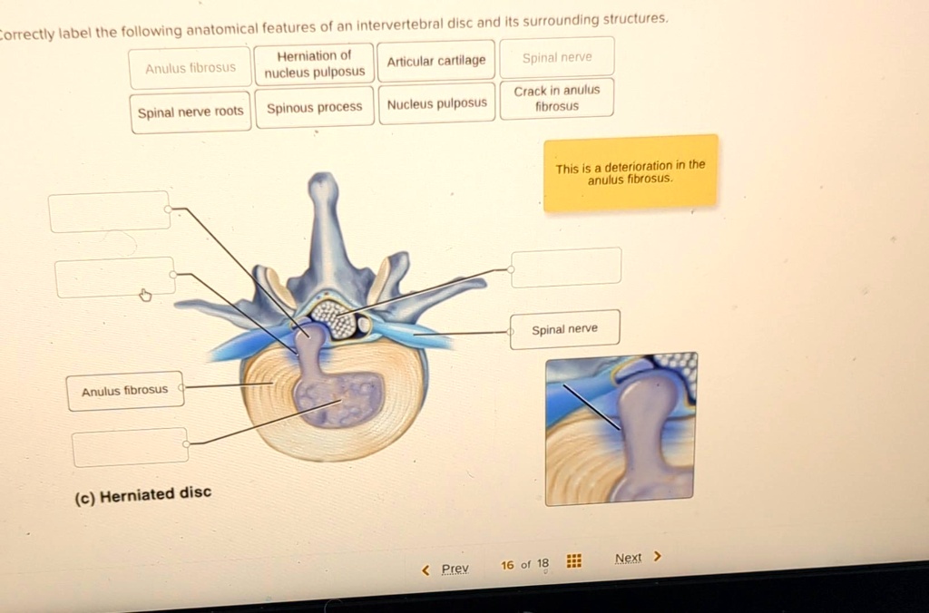 corrected text correctly label the following anatomical features of an ... corrected text correctly label the following anatomical features of an ...