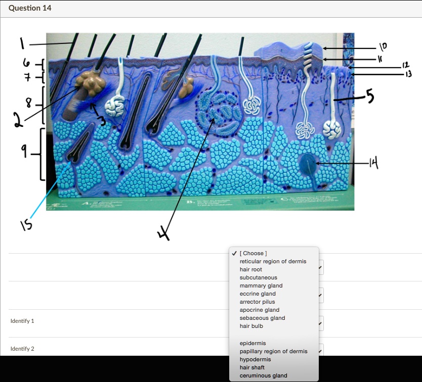 Question 14 10 12 13 + 5 8 1 14 [Choose] reticular region of dermis ...