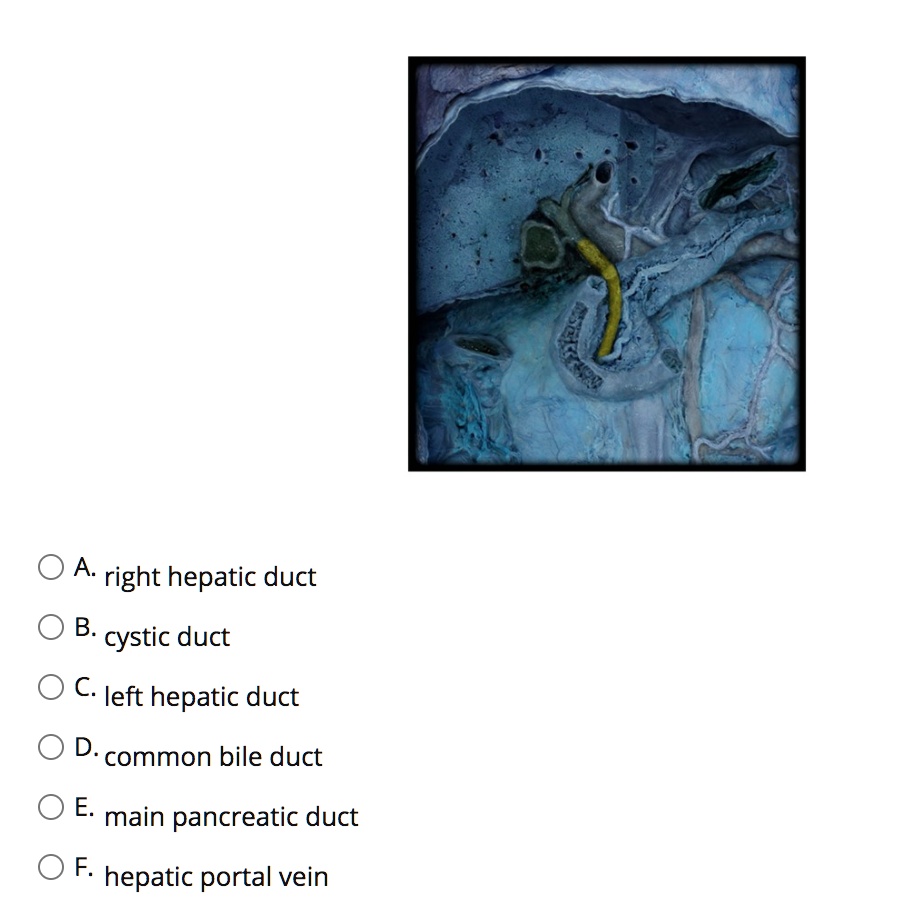 SOLVED: Identify the highlighted blue structure. O A. right hepatic ...