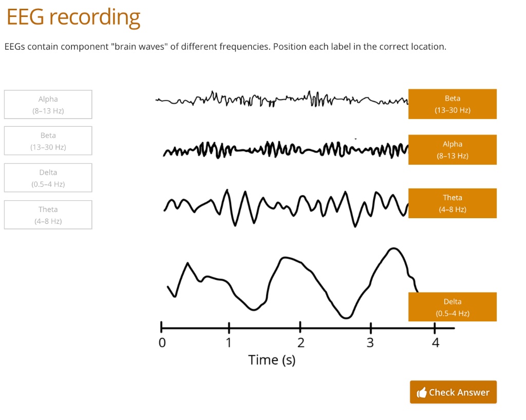 SOLVED: EEG recording: EEGs contain components "brain waves" of different frequencies. Position ...