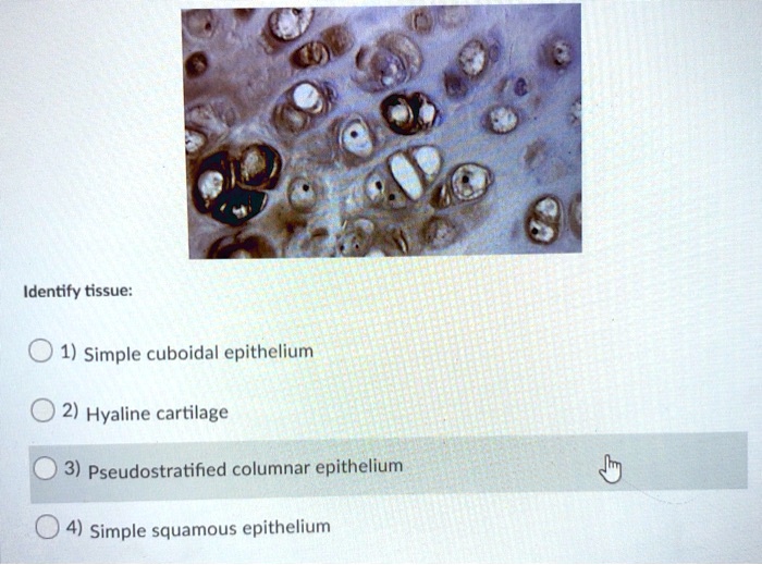 SOLVED: Identify tissue: 1. Simple cuboidal epithelium 2. Hyaline cartilage 3. Pseudostratified ...