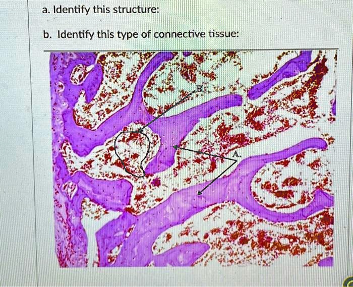 SOLVED: a. Identify this structure: b. Identify this type of connective tissue: B. a.Identify ...