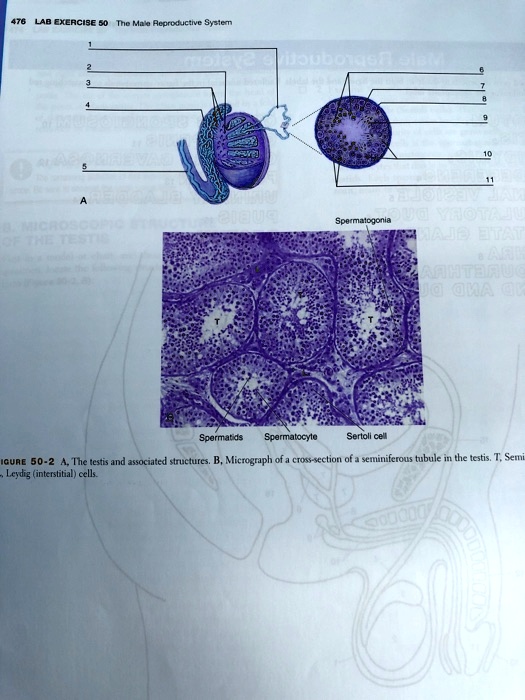 476 LAB EXERCISE 50 The Male Reproductive System 2 3 4 5 A ...
