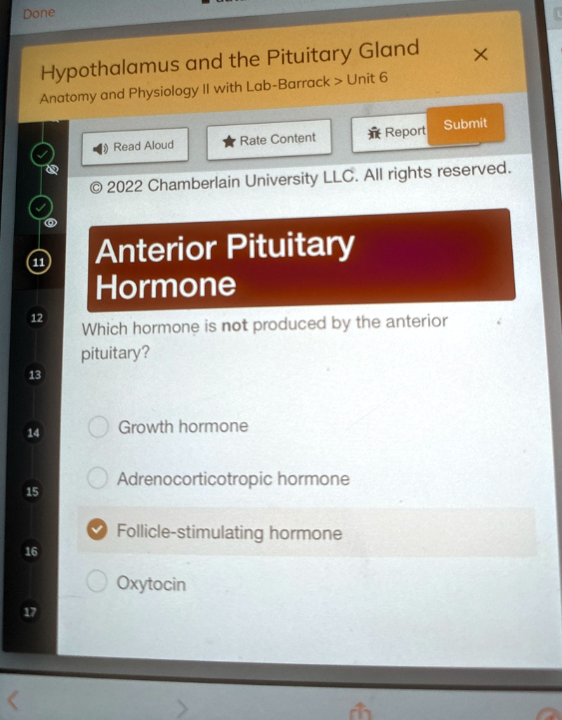 Hypothalamus and the Pituitary Gland Anatomy and Physiology II with Lab ...