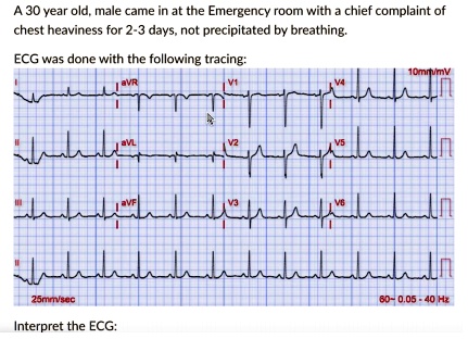 Interpret the ECG: Compute for the heart rate: Identify the rhythm P ...
