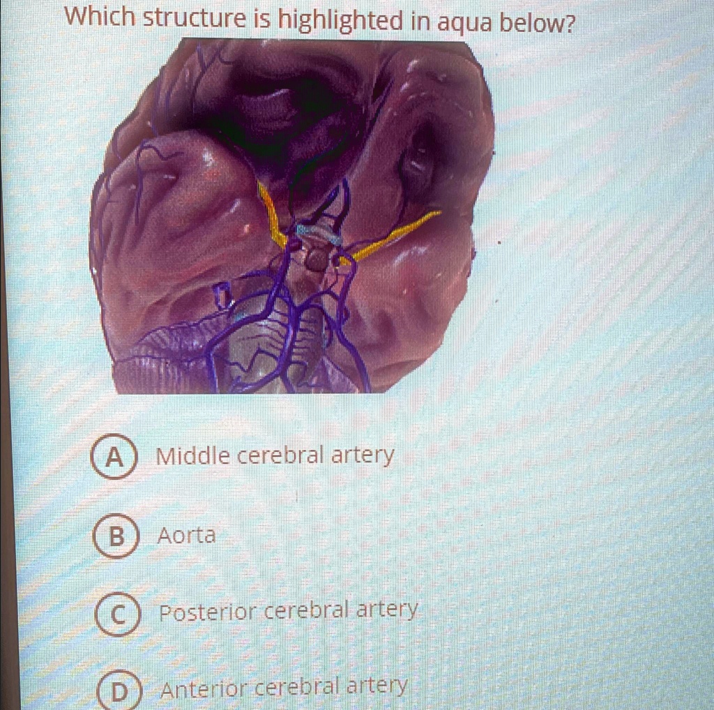 Which structure is highlighted in aqua below? (A) Middle cerebral ...