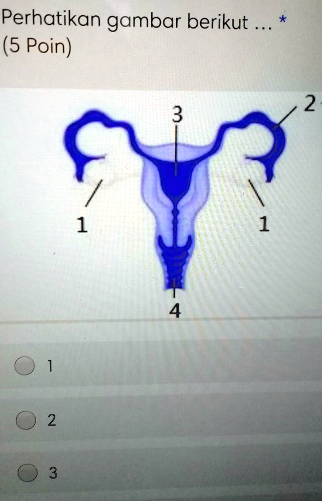 SOLVED: Perhatikan gambar berikut Perhatikan gambar berikut (5 Poin) 2 ... SOLVED: Perhatikan gambar berikut Perhatikan gambar berikut (5 Poin) 2 ...