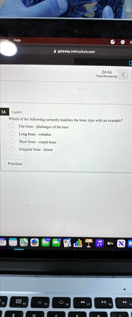 16 1 point Which of the following correctly matches the bone type with ...