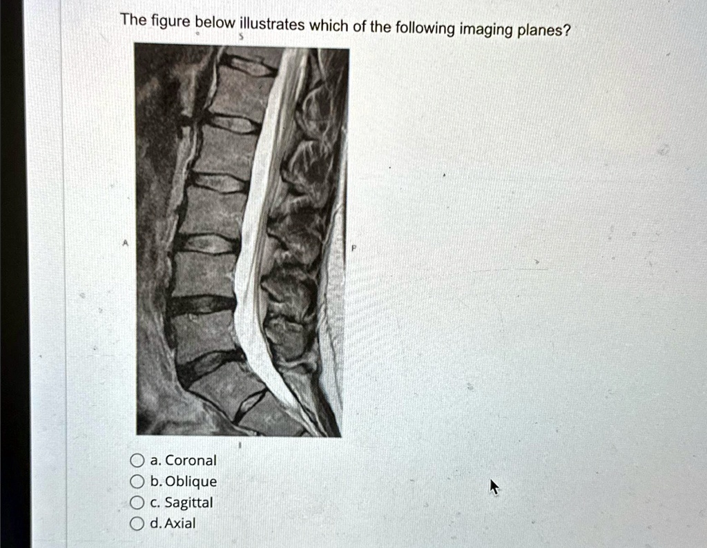 The figure below illustrates which of the following imaging planes? a ...
