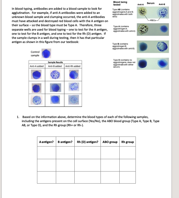 In blood typing, antibodies are added to a blood sample to look for ...