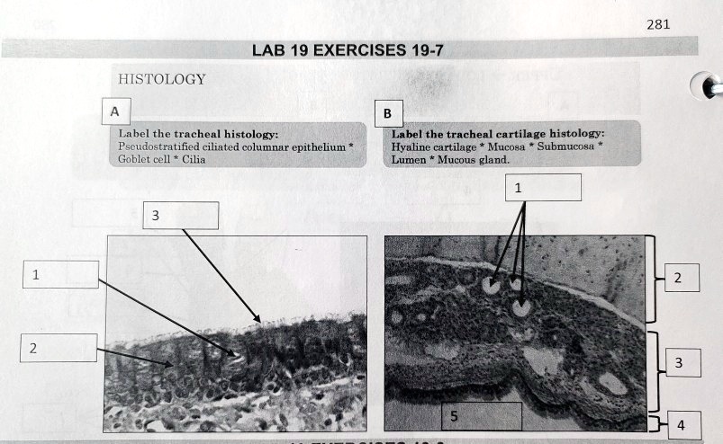 SOLVED: LAB 19 EXERCISES 19-7 HISTOLOGY Label the tracheal histology ... SOLVED: LAB 19 EXERCISES 19-7 HISTOLOGY Label the tracheal histology ...