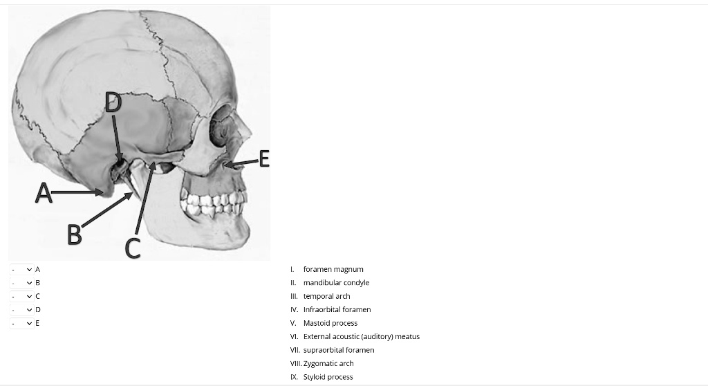 D -E A- B C D E B C I. foramen magnum II. mandibular condyle III ...