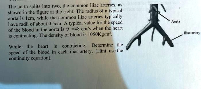 The aorta splits into two, the common iliac arteries, as shown in the ...