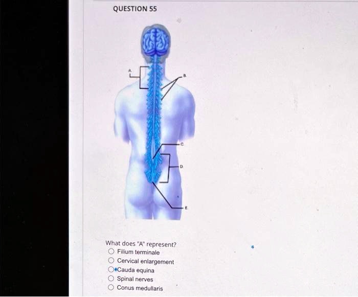 SOLVED: What does "A" represent? A. Filium terminale B. Cervical ...