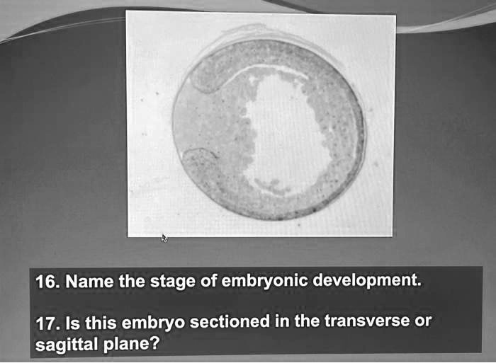SOLVED: 16. Name the stage of embryonic development. 17. Is this embryo ...