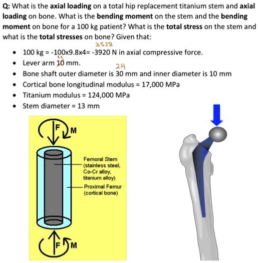 Q: What is the axial loading on a total hip replacement titanium stem ...