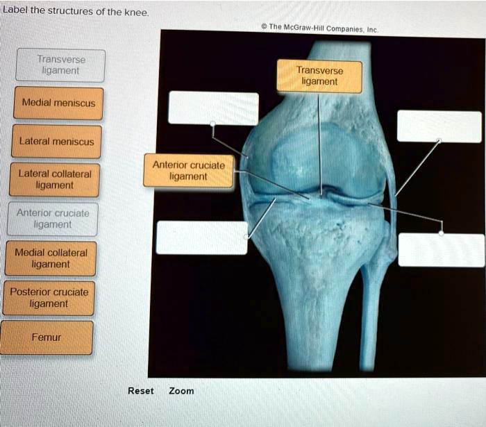 SOLVED: Label the structures of the knee The McGraw-Hill Companies, Inc. Transverse ligament ...
