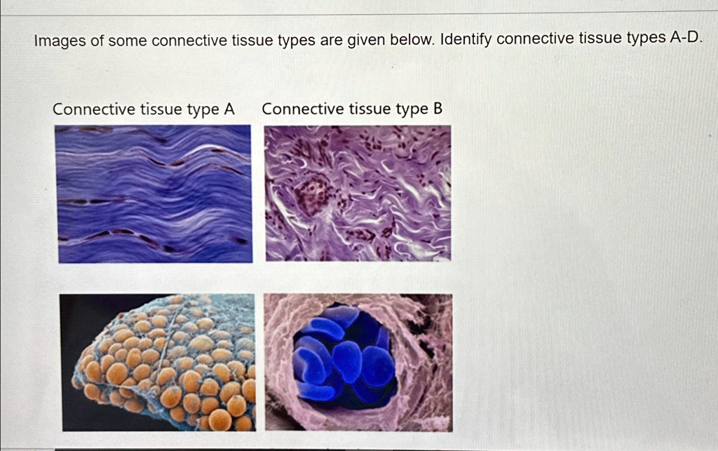 Images of some connective tissue types are given below. Identify ...