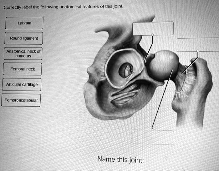 correctly label ihe following anatomical features of this joint labrum ...