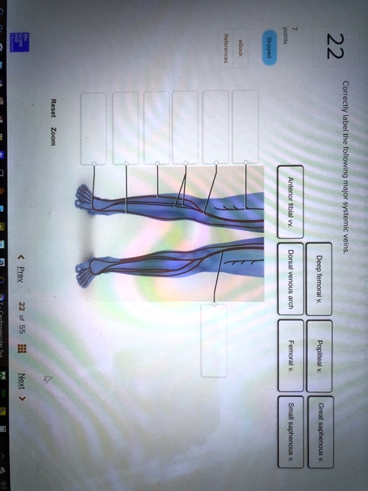 SOLVED: Skipped Points Correctly label the following major systemic veins: - Anterior tibial ...
