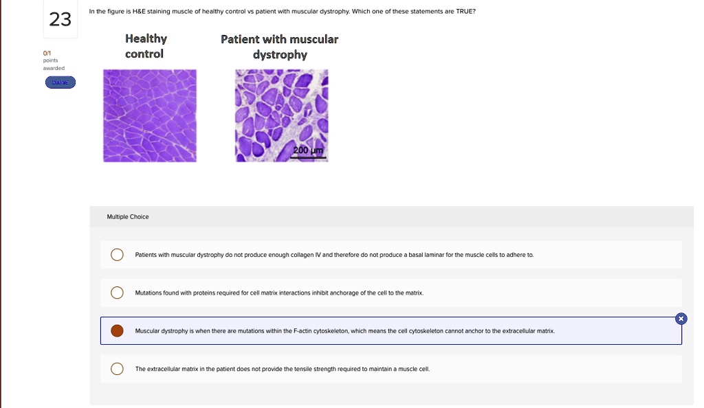 23 0/1 points awarded In the figure is H E staining muscle of healthy ...