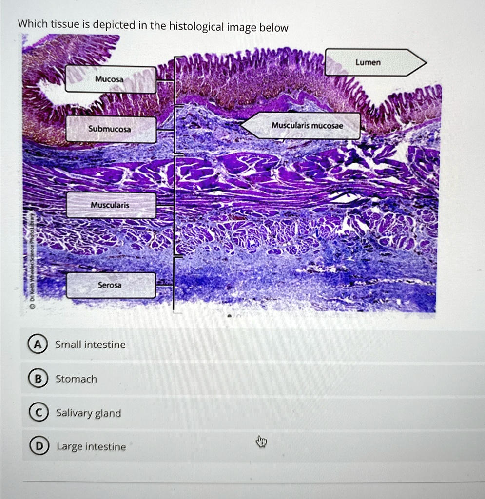 which tissue is depicted in the histological image below mucosa ...