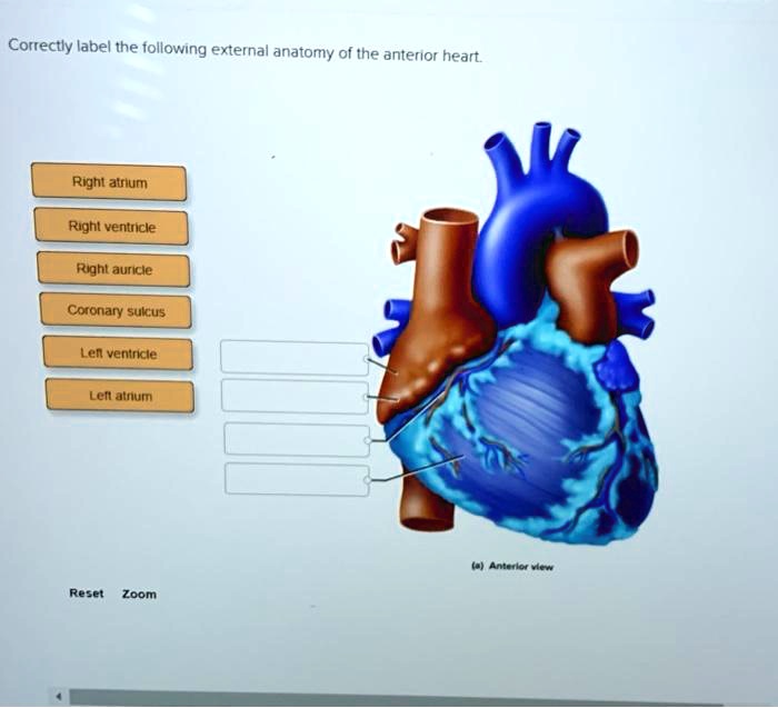 SOLVED: Correctly label the following external anatomy of the anterior ...